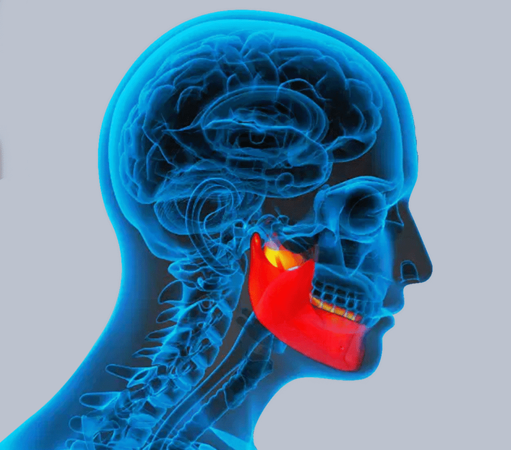 TMJ Therapy for Jaw Pain by Geach Dental